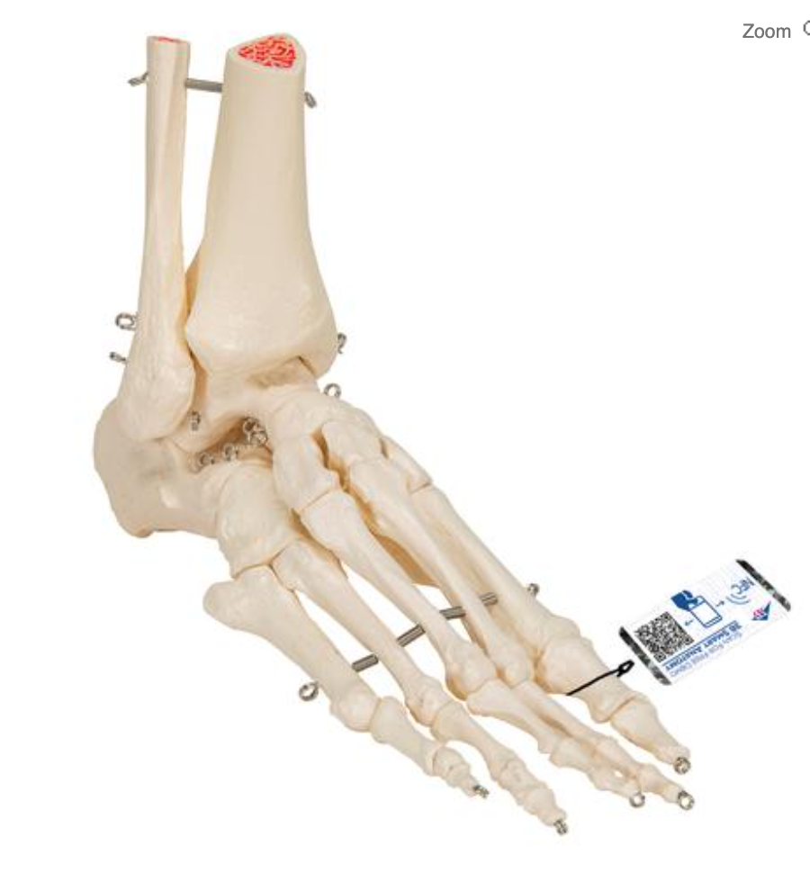 0974-31 Budget Foot, Wire mounted with Distal Tibia and Fibula ...