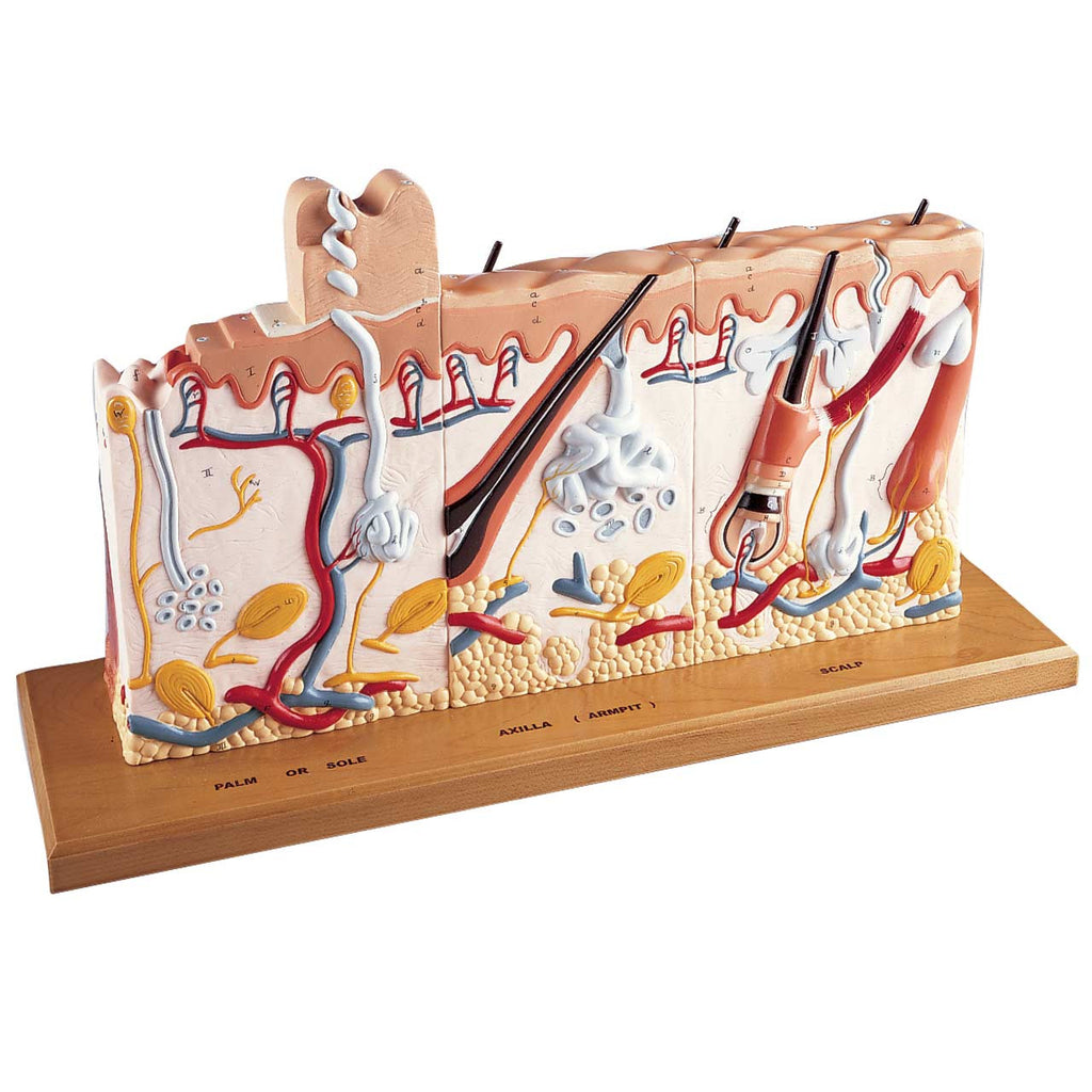 Human Skin Series with Burn Pathologies | Denoyer-Geppert – Denoyer ...