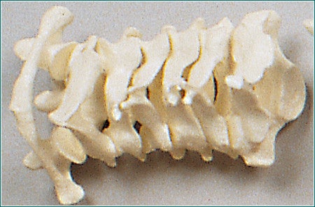 SB12-1 Cervical Vertebrae Set (C1 through C7) Color coded – Denoyer ...