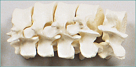 SB18 Lumbar Vertebrae Set (L1 through L5) - Blue – Denoyer-Geppert ...