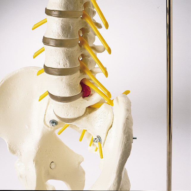 SP65 Premier Flexible Spine with herniated disc with femur heads and s ...